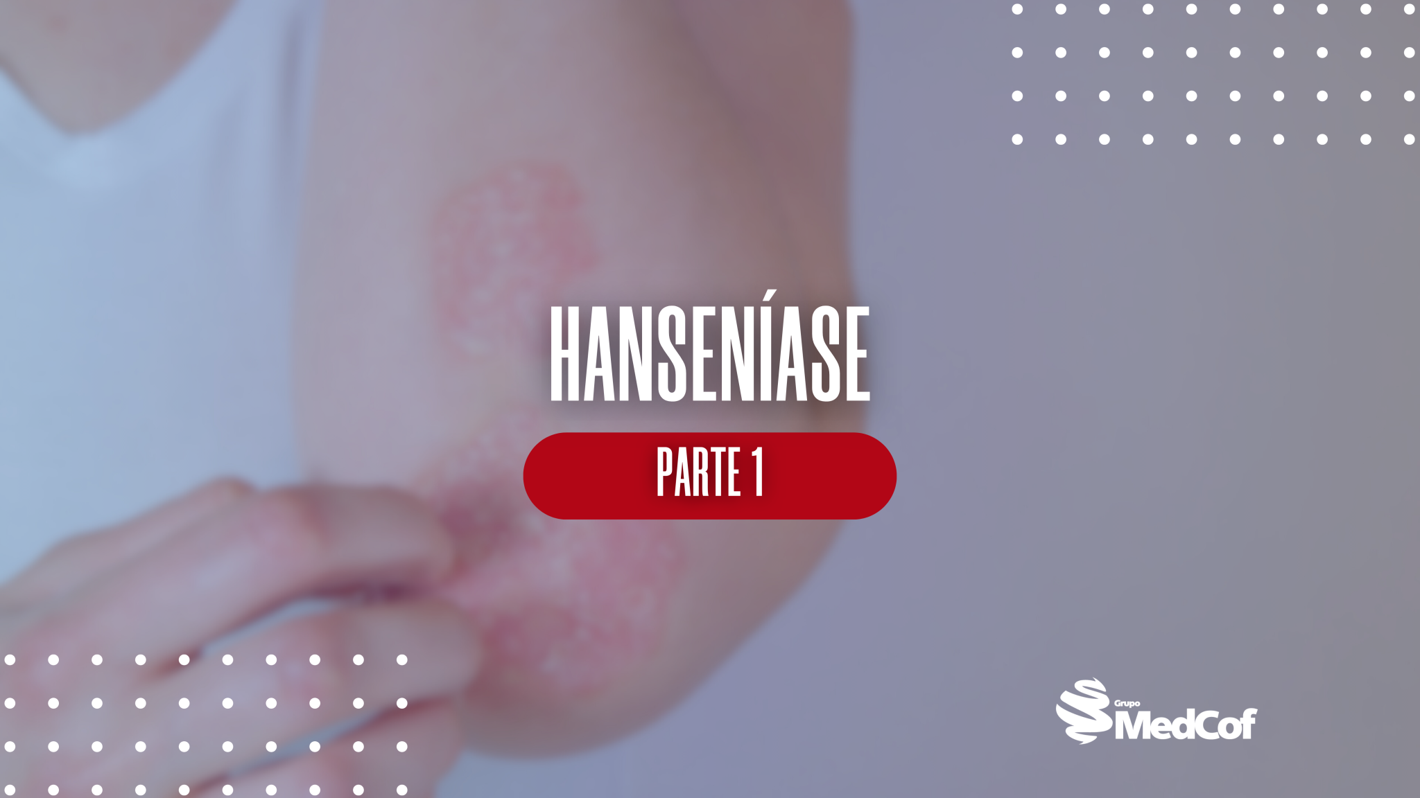 Como ocorre a transmissão da hanseníase? - Blog de Medcof: conteúdos ...