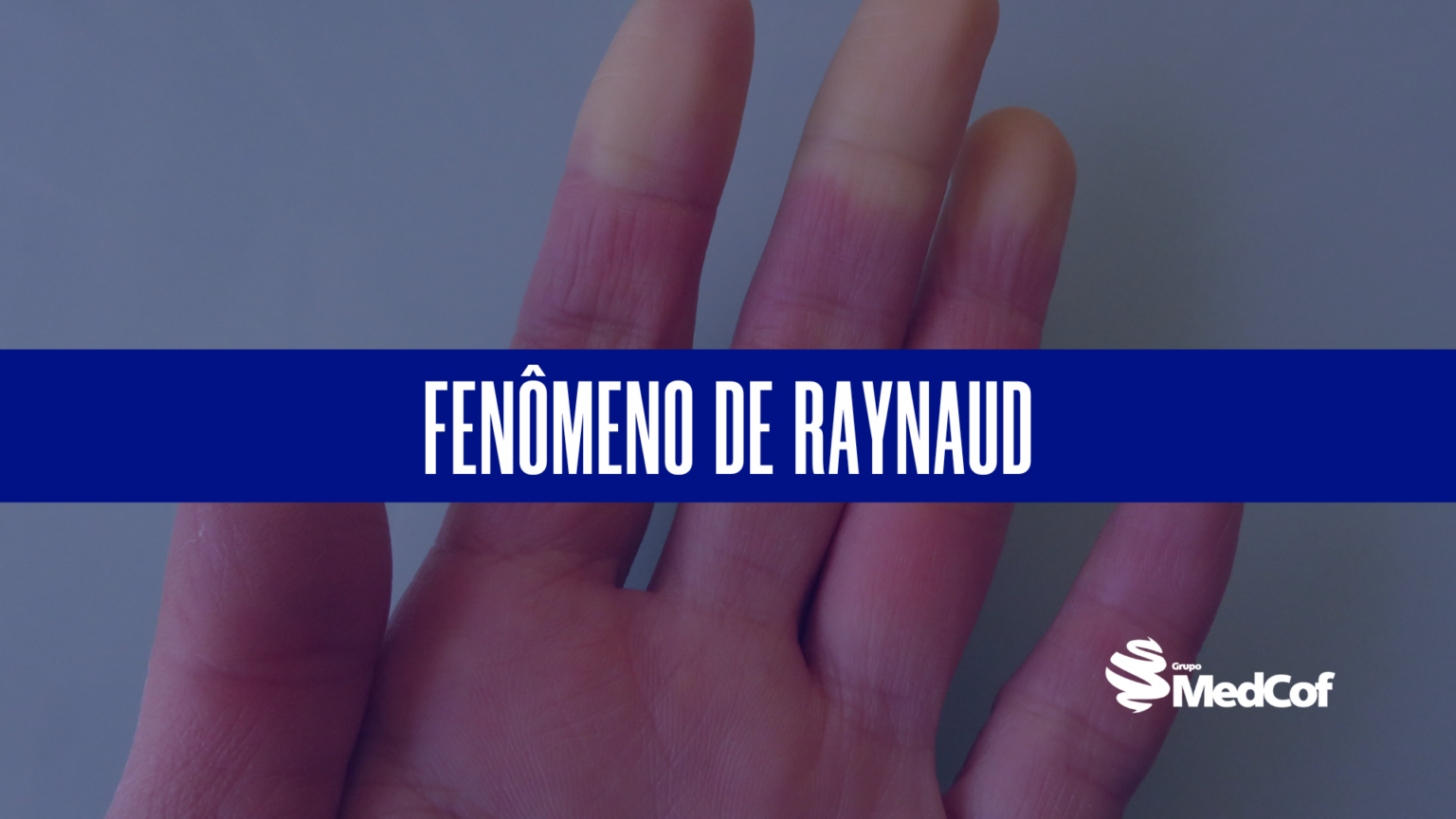Fenômeno de Raynaud: aprenda a identificar - Blog de Medcof: conteúdos ...