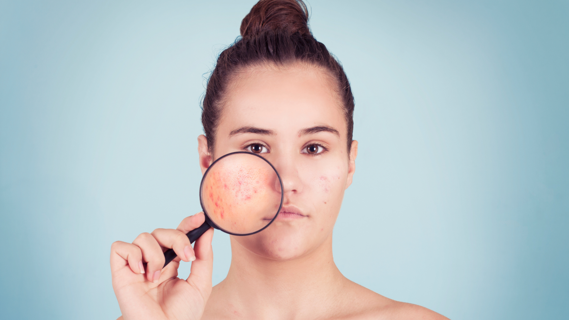 Entenda a diferença entre puberdade e adolescência - Blog de Medcof ...